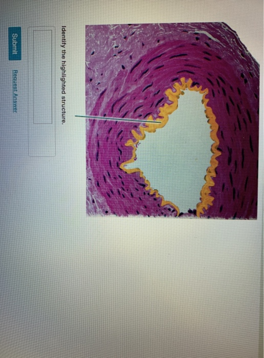 Solved Identify the highlighted vessel. Submit Request | Chegg.com