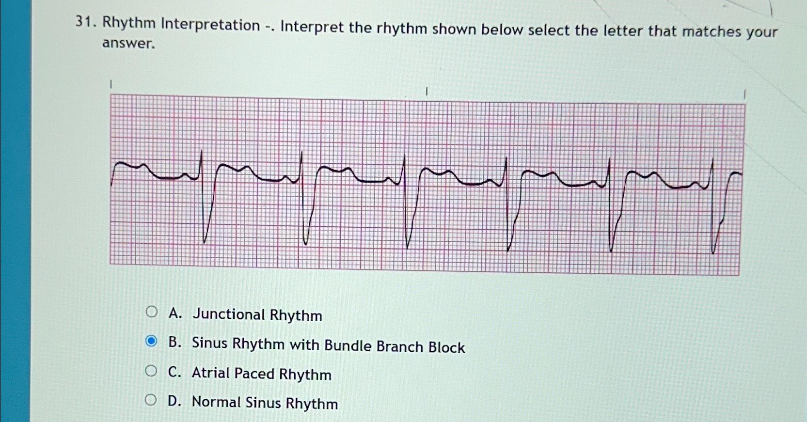 Solved Rhythm Interpretation -. ﻿Interpret the rhythm shown | Chegg.com