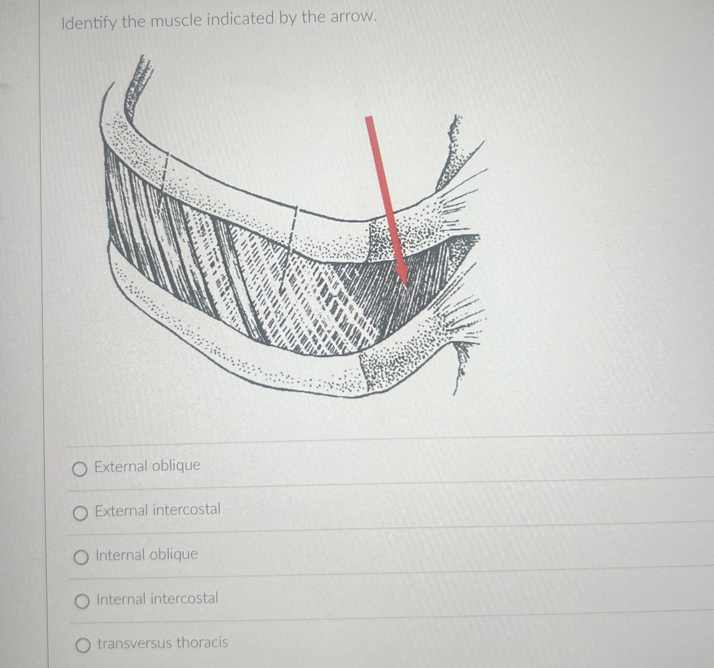 Solved Identify the muscle indicated by the arrow.External | Chegg.com