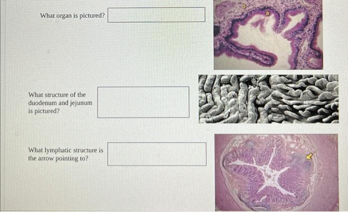 Solved What structure is pictured? What mucosa is the arrow | Chegg.com