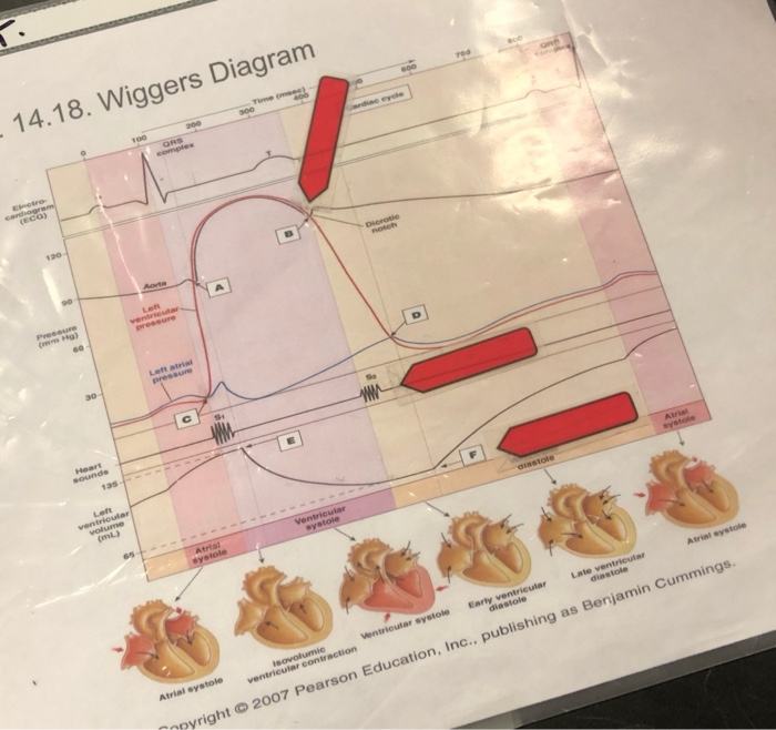 Station 20: Wigger's Diagram Be prepared to answer | Chegg.com