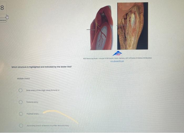 Waich structure is highlghted and indiceted by the | Chegg.com