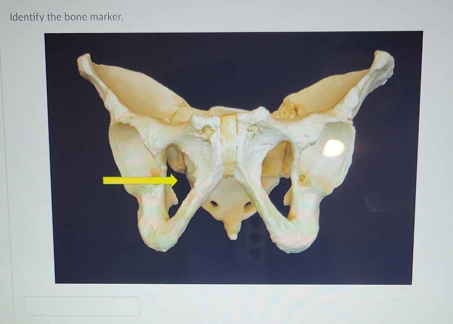 Solved Identify the bone marker indicated by the red | Chegg.com