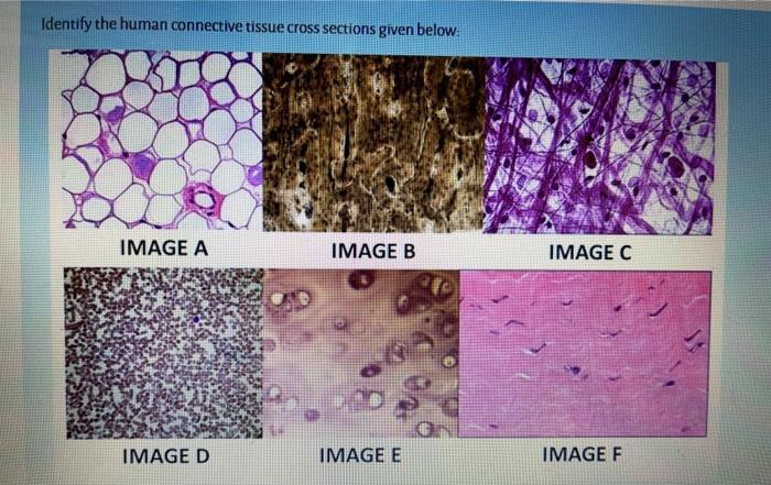 Solved Identify the human connective tissue cross sections | Chegg.com