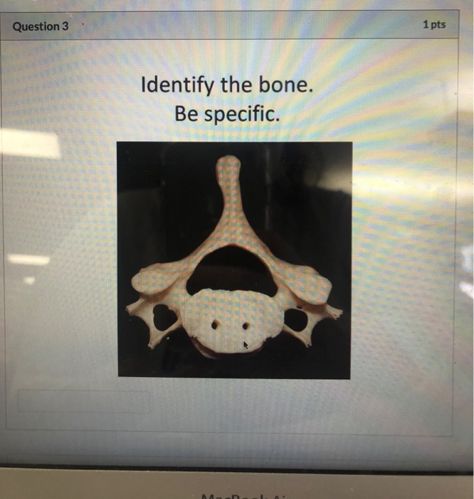 Solved uestion 1 1 pts Identify the arrowed structure. Be | Chegg.com Solved uestion 1 1 pts Identify the arrowed structure. Be | Chegg.com