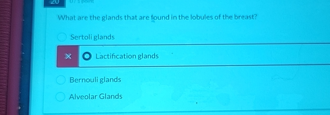 Solved What are the glands that are found in the lobules of | Chegg.com