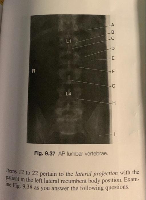 Solved 11. Identify each lettered structure of the lumbar | Chegg.com