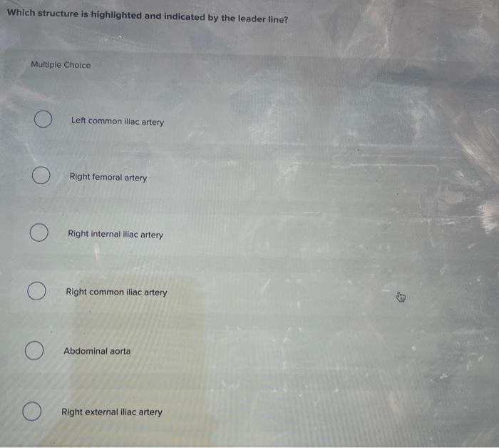 Solved Which structure is highlighted and indicated by the | Chegg.com
