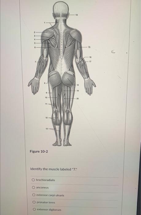 Solved Identify the muscle labeled "7." brachloradialis | Chegg.com