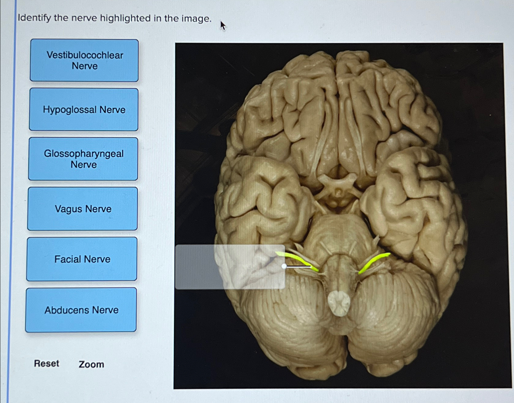 Solved Identify the nerve highlighted in the image.ResetZoom | Chegg.com