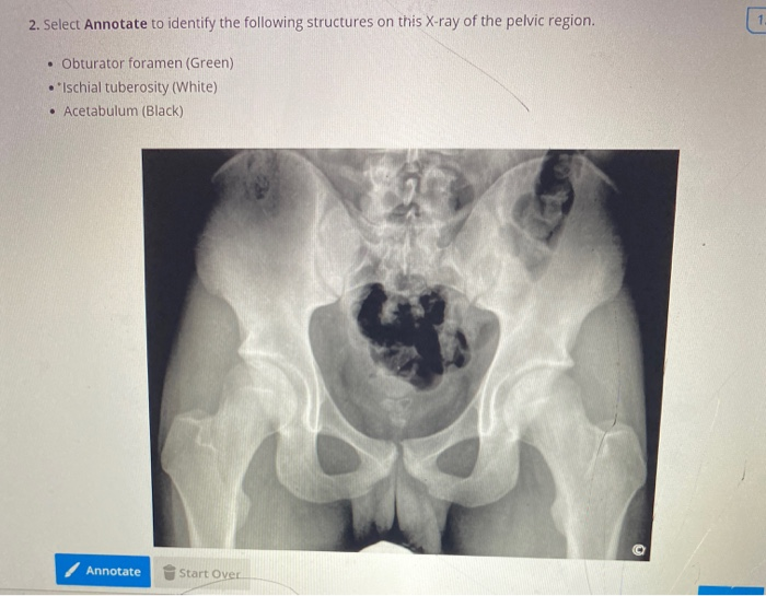 Solved 2. Select Annotate to identify the following | Chegg.com