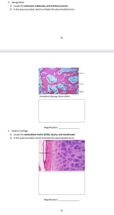 Solved 2. Spongy Bone 1) Locate the osteocyte, trabeculae, | Chegg.com