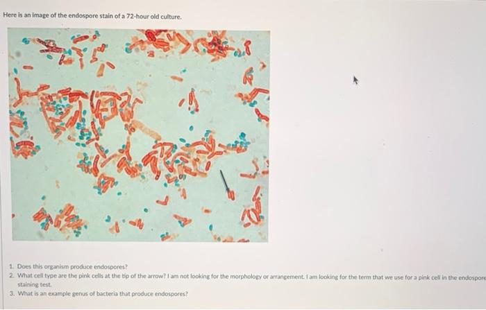 Solved Here is an image of the endospore stain of a 72-hour | Chegg.com