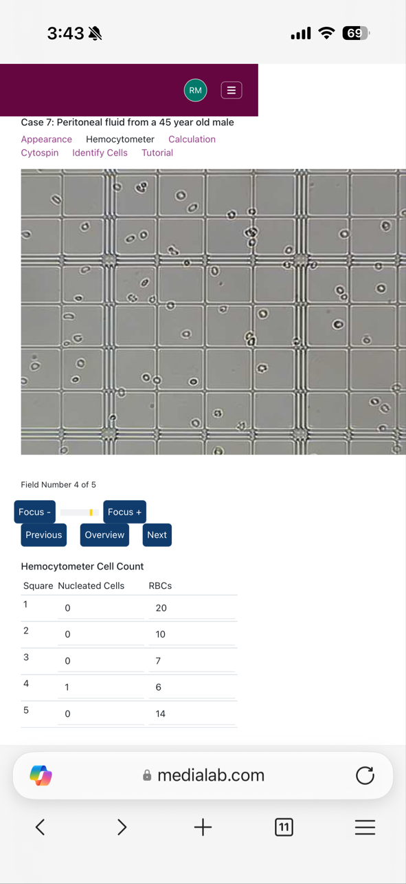 3:43RMCase 7: Peritoneal fluid from a 45 ﻿year old | Chegg.com