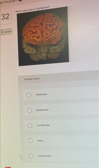 Solved Which structure is highlighted? 34 Multiple Choice | Chegg.com