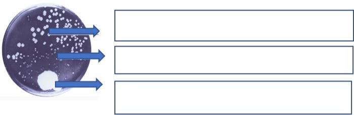 Solved The following picture represents Alexander Fleming’s | Chegg.com