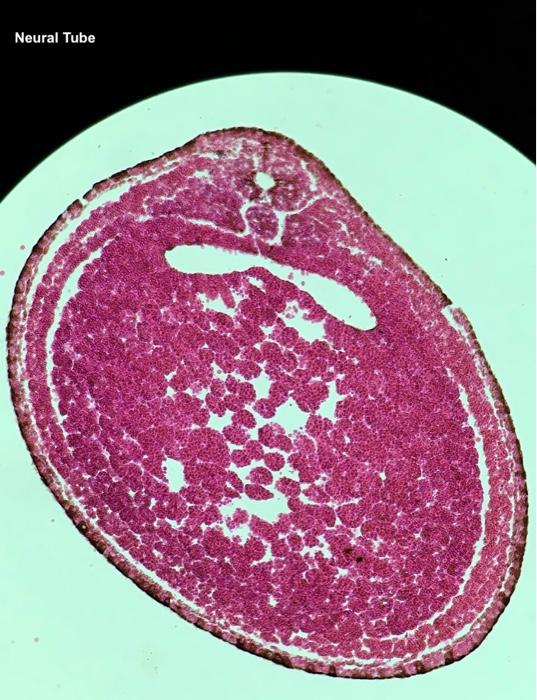 Solved Neural Tube Neural Fold | Chegg.com