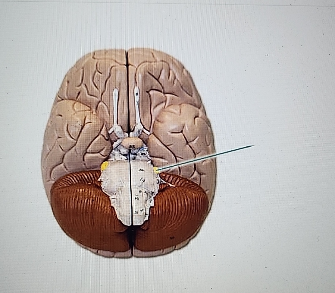 Solved structure highlyghted yellowbrain model anatomy | Chegg.com