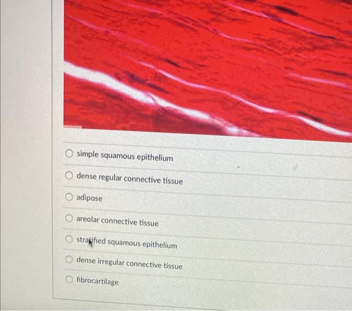 Solved This tissue is: simple squamous epithelium dense | Chegg.com