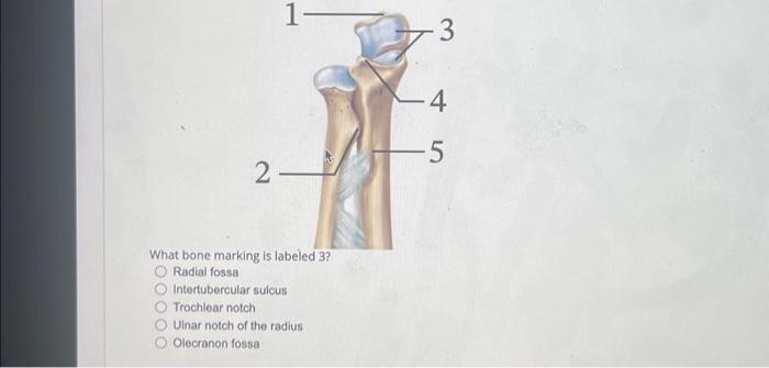 Solved 2 1- 45 What bone marking is labeled 3? Radial fossa | Chegg.com