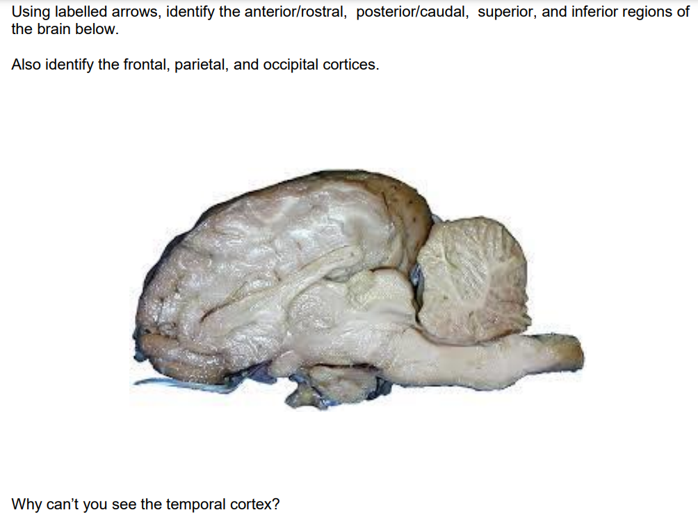 Solved Using labelled arrows, identify the anterior/rostral, | Chegg.com