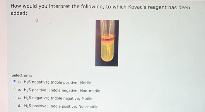 Solved Your urea digestion culture tube is pink after | Chegg.com