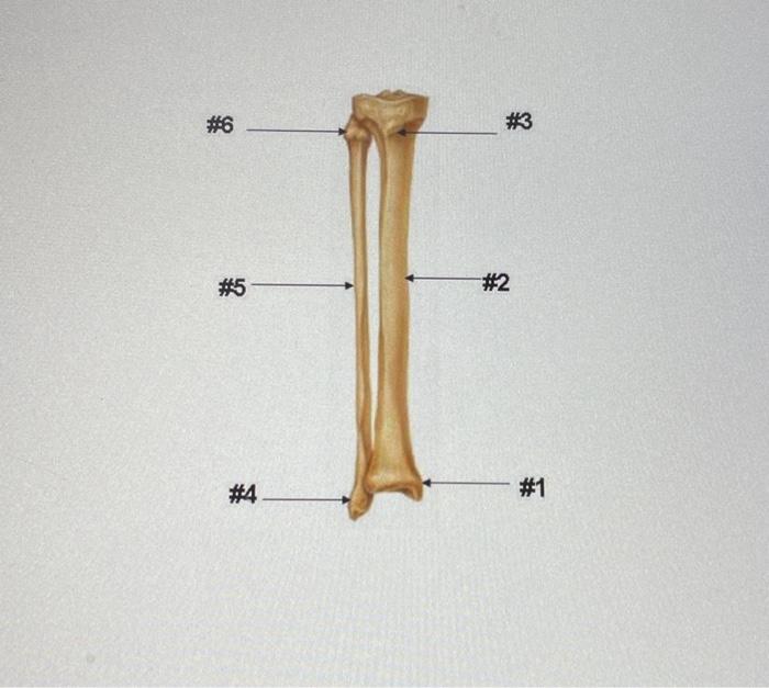 Solved lable the bones | Chegg.com