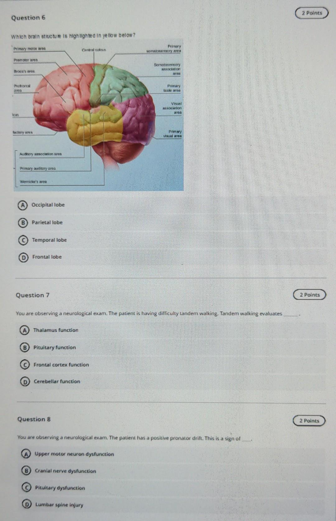 Solved Question 6 Which brain structure is highlighted in | Chegg.com