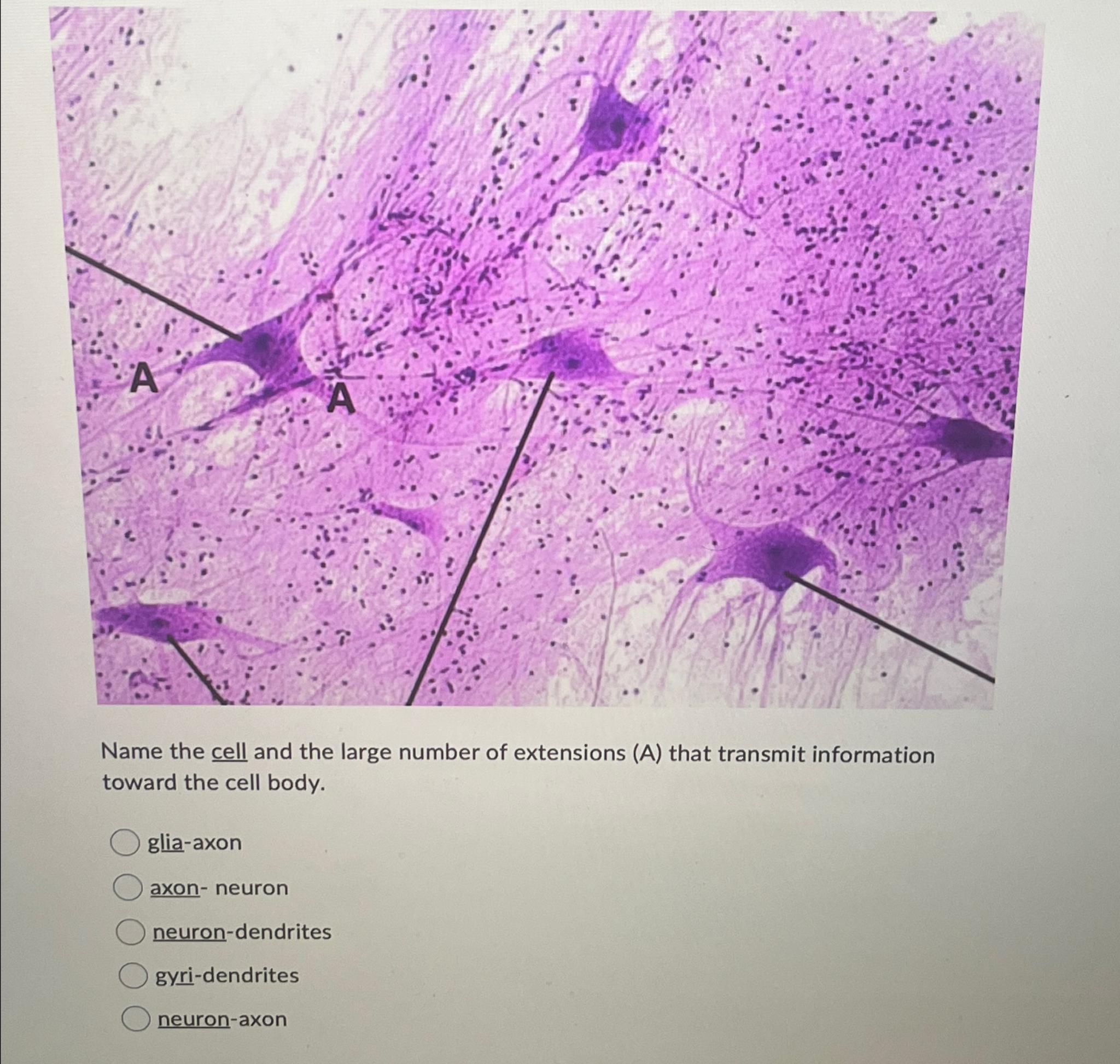 Solved Name the cell and the large number of extensions (A) | Chegg.com