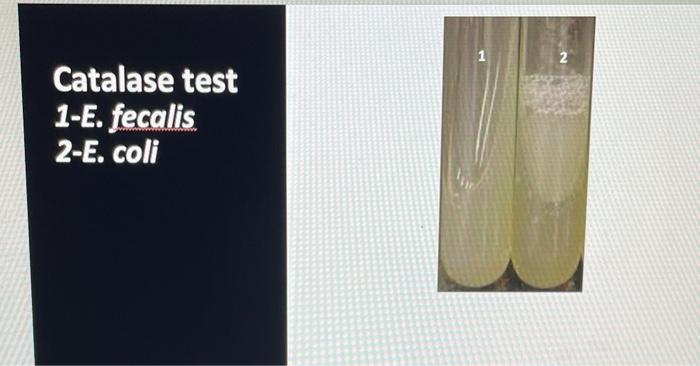 Solved Catalase test-I wokine at the results nresentation | Chegg.com