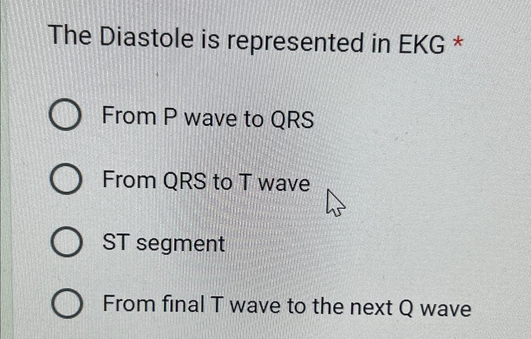 Solved The Diastole is represented in EKG *From P ﻿wave to | Chegg.com