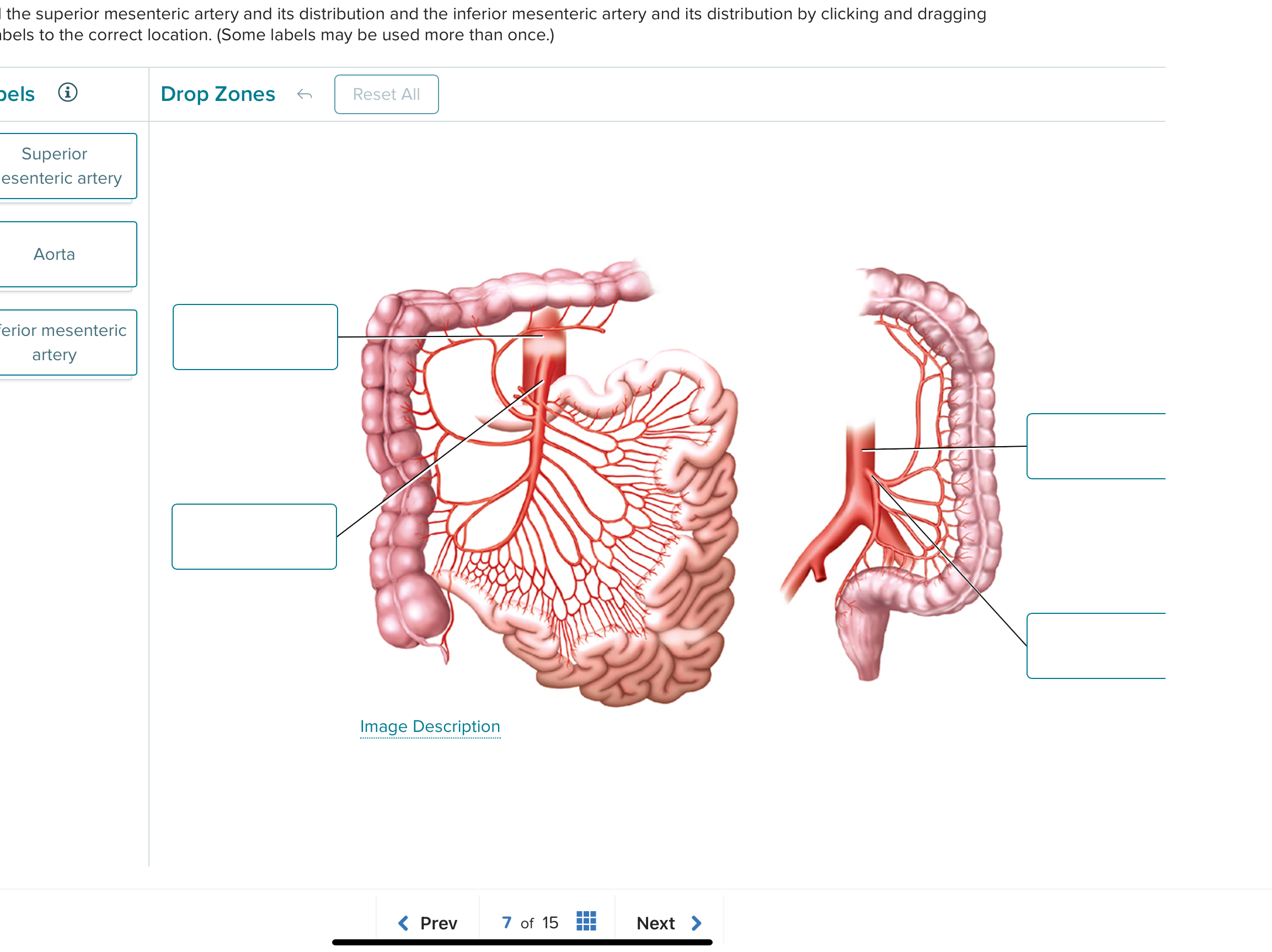 Solved The Superior Mesenteric Artery And Its Distribution