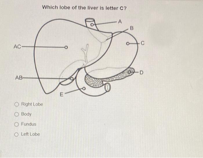 Solved Which lobe of the liver is letter C ? Right Lobe Body | Chegg.com
