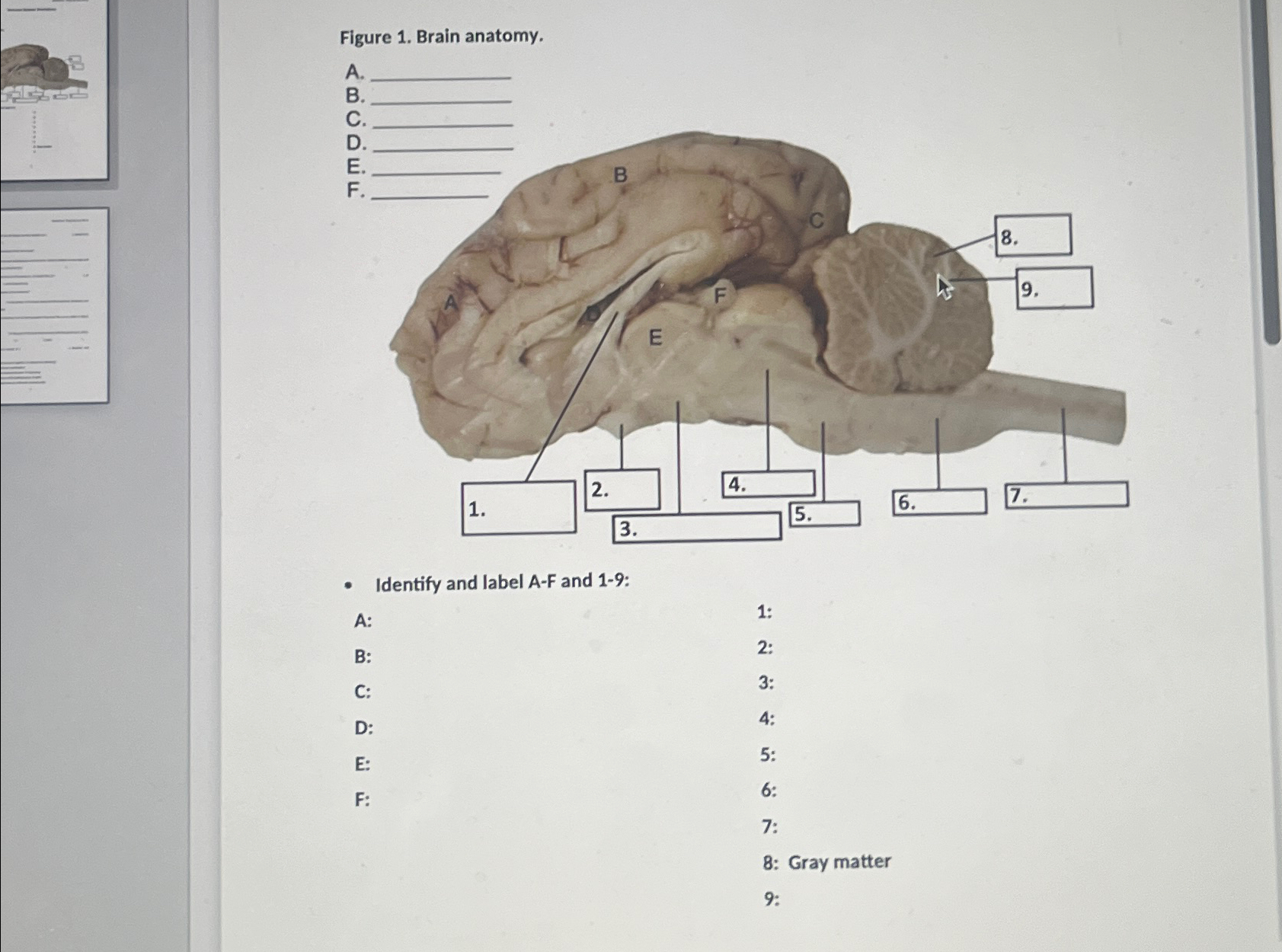 Solved Figure 1. ﻿Brain | Chegg.com