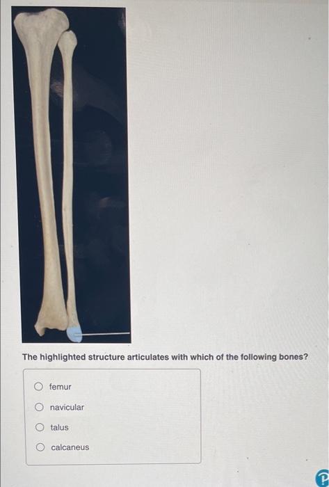 Solved The highlighted structure articulates with which of | Chegg.com