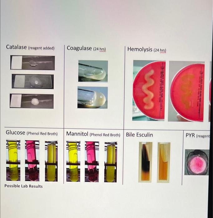 Unknown #43 Gram Stain Lab Results Catalase reagent | Chegg.com