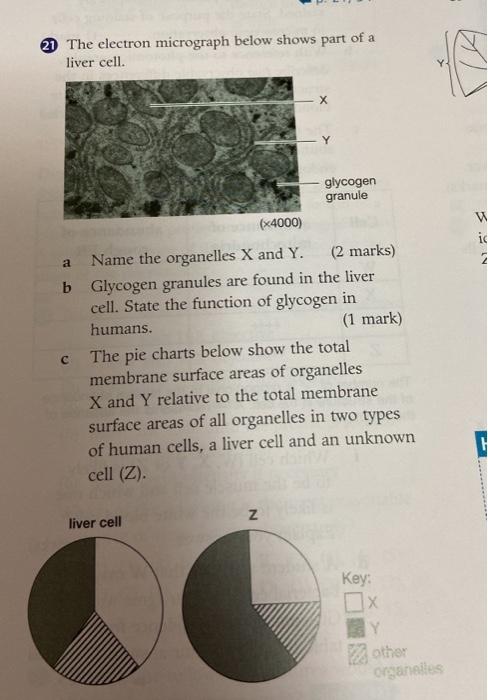 Solved 21 The electron micrograph below shows part of a | Chegg.com