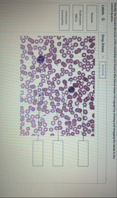Identify the formed elements of the blood that are | Chegg.com