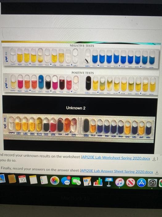 Name API 20E Lab Answer Sheet 1. What was your API | Chegg.com