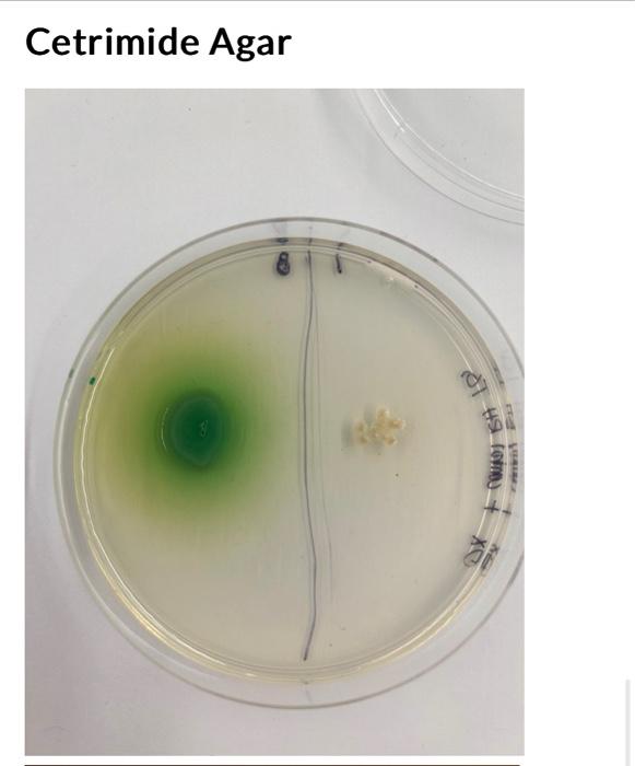 EXERCISE 14: BLOOD AGAR PLATE(BAP) Complete the table | Chegg.com