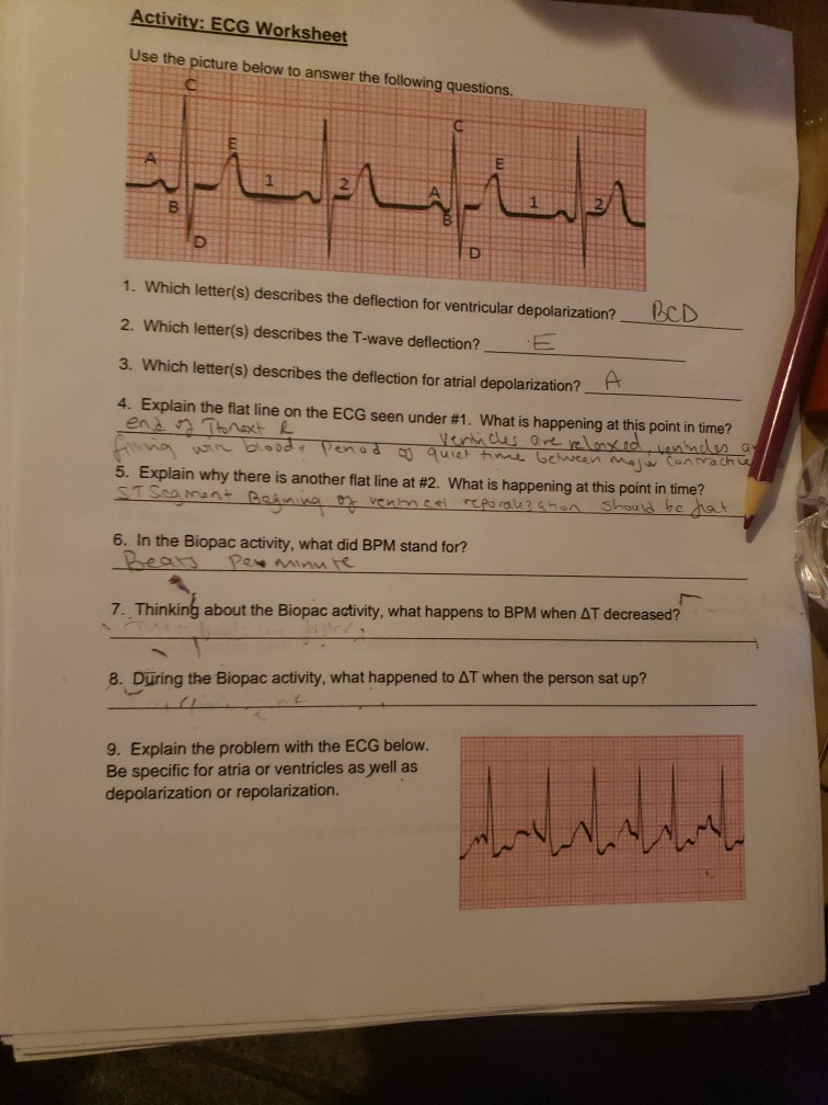 Solved Activity: ECG Worksheet Use the picture below to | Chegg.com Solved Activity: ECG Worksheet Use the picture below to | Chegg.com