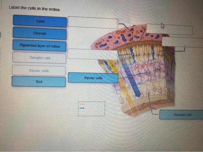 Label the cells in the retina. Cone Choroid Pigmented | Chegg.com