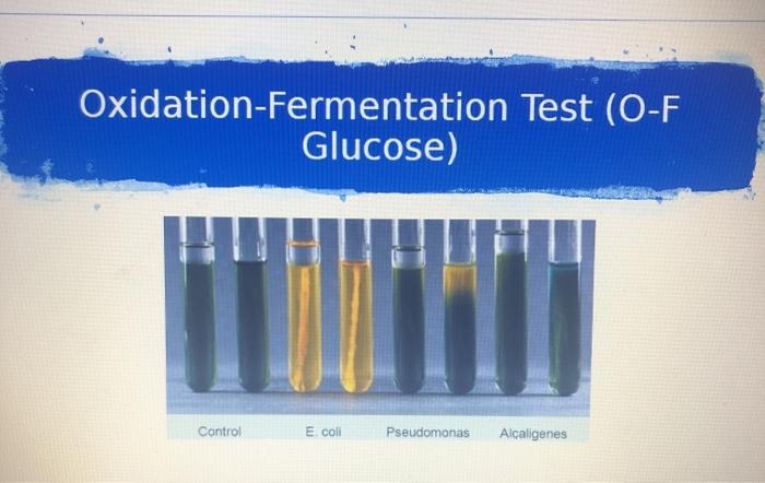 Solved Biochemical Testing Results and Interpretation: | Chegg.com
