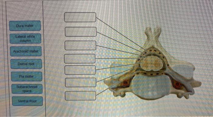 Solved Dura mater Lateral white column QUOD Arachnoid mater | Chegg.com