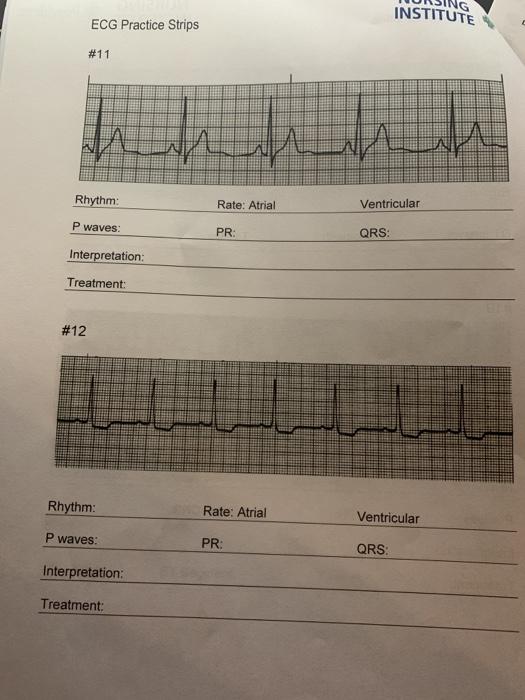 Solved AG INSTITUTE ECG Practice Strips #11 ha numrin | Chegg.com