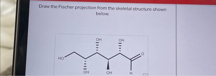 Solved Draw the Fischer projection from the skeletal | Chegg.com