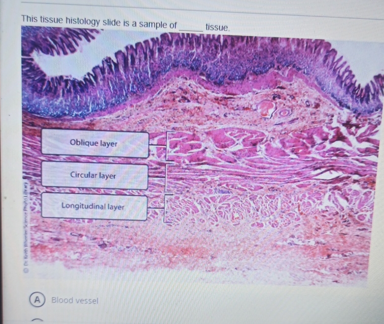 Solved This tissue histology slide is a sample of q, | Chegg.com