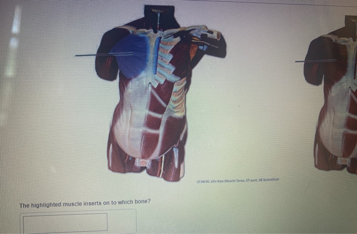 Solved Identify the highlighted muscle. The highlighted | Chegg.com