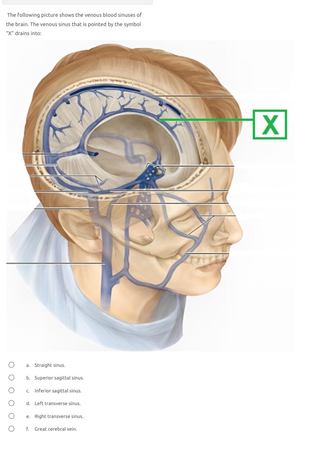 Solved The following picture shows the venous blood sinuses | Chegg.com