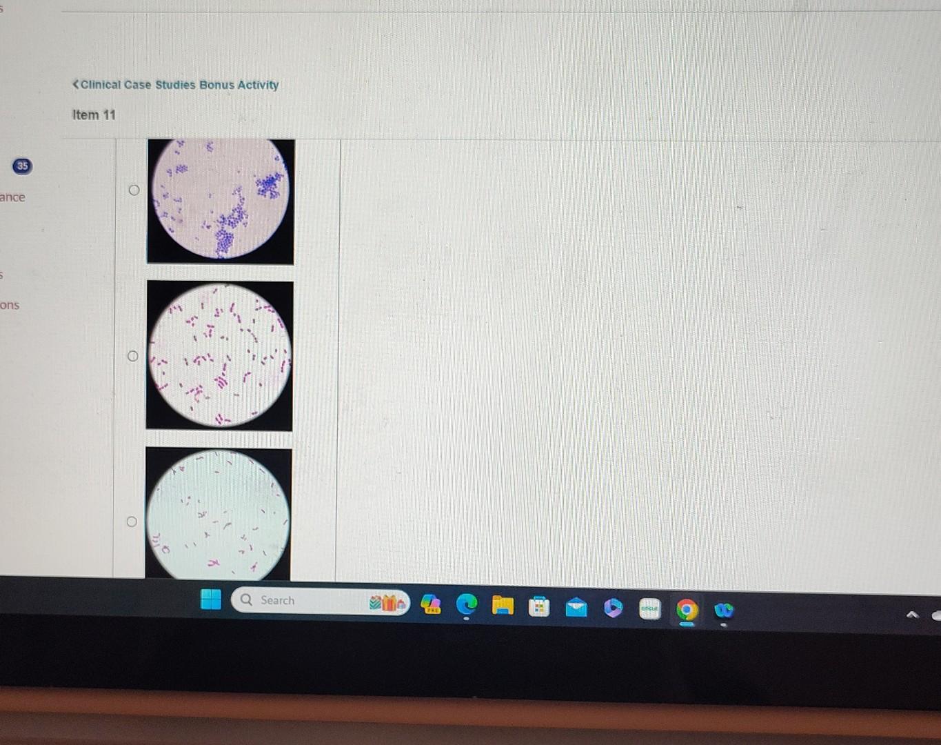 Solved Clinical Case Studies Bonus Activity Due Monday by | Chegg.com